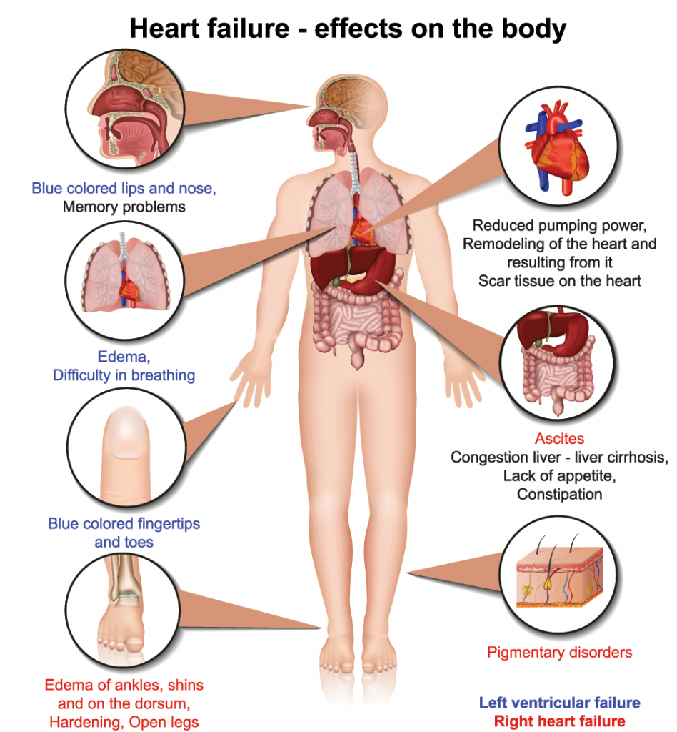 Heart Medical Conditions in Turnersville, NJ | Premier Heart